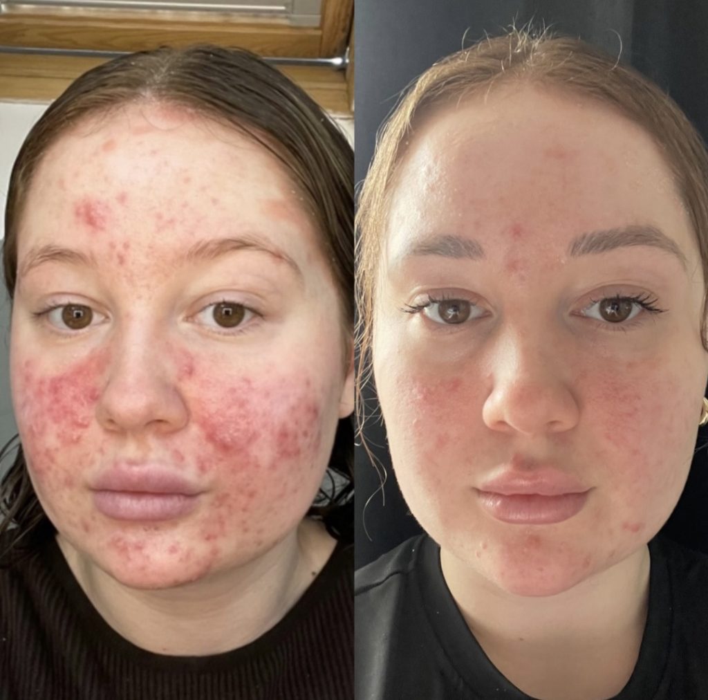 Enhance My Skin - Clinical Grade Results, From Your Own Home.